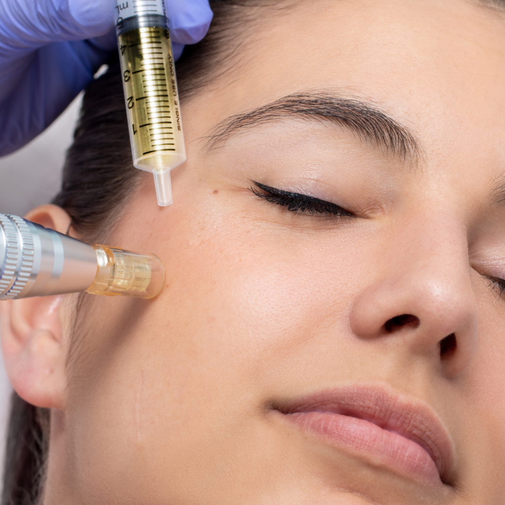 Platelet Rich Plasma (PRP) - Arubia Training